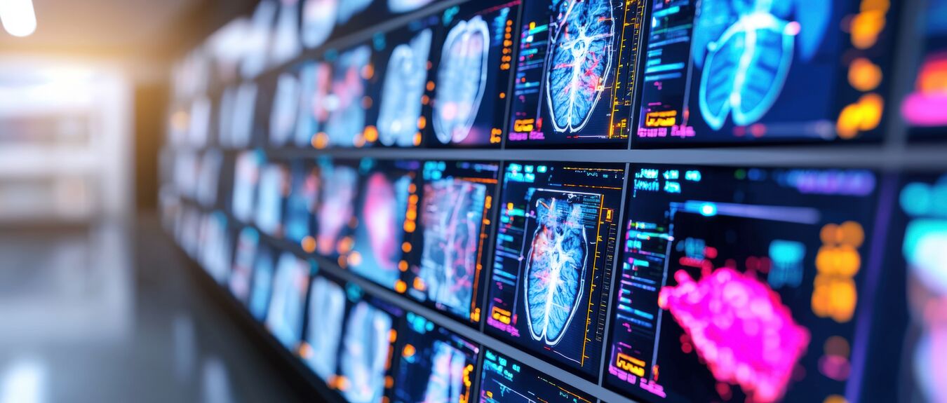 EU moves to align Notified Bodies’ practices under the MDR and IVDR